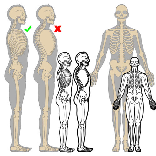 Body Posture of Skeleton Clipart | Skeletal System Anatomy ...