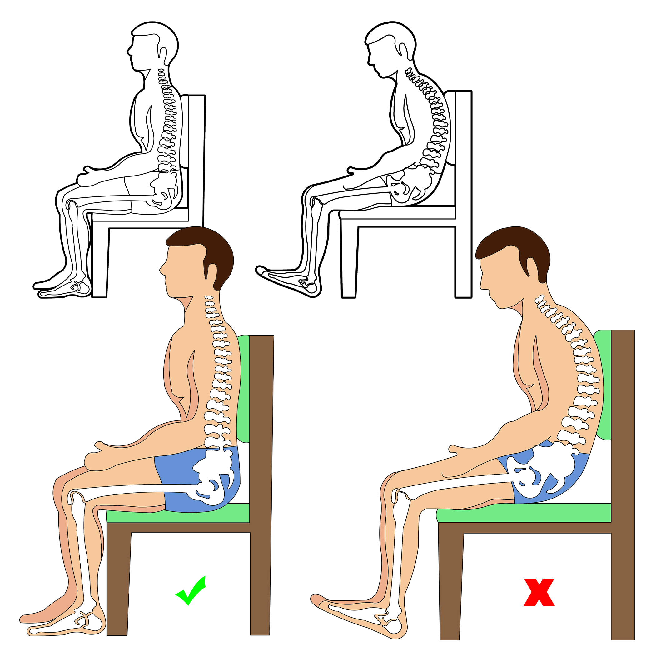 Body Posture of Skeleton Clipart | Skeletal System Anatomy ...