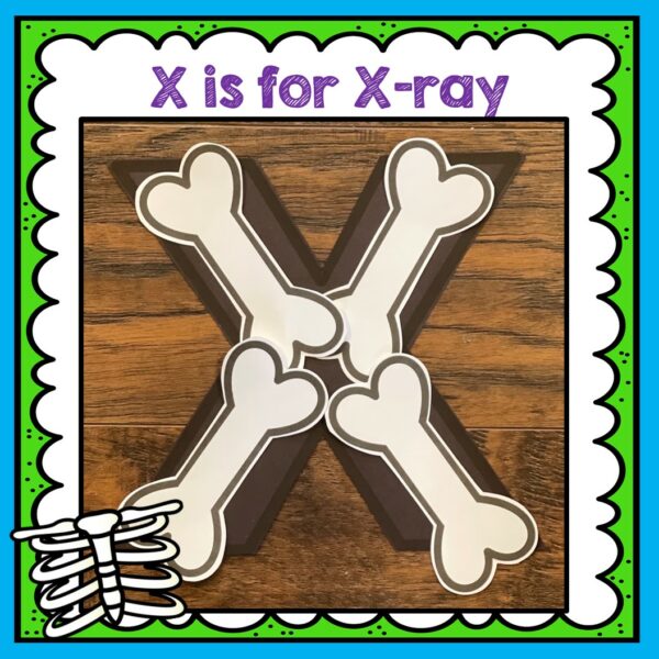 Letter X Craft, Alphabet Craft, Xx is for X-ray, X-ray Craft, Bones ...
