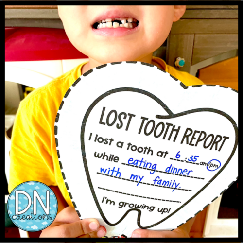 Lost Tooth Awards Notes and Classroom Displays l I Lost a Tooth | Made ...