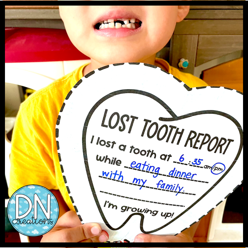 Lost Tooth Awards Notes and Classroom Displays l I Lost a Tooth | Made ...